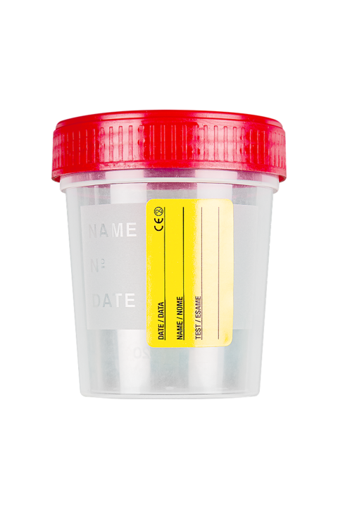 Sterile Urine Containers & Stool Sample Containers — Specimen ...